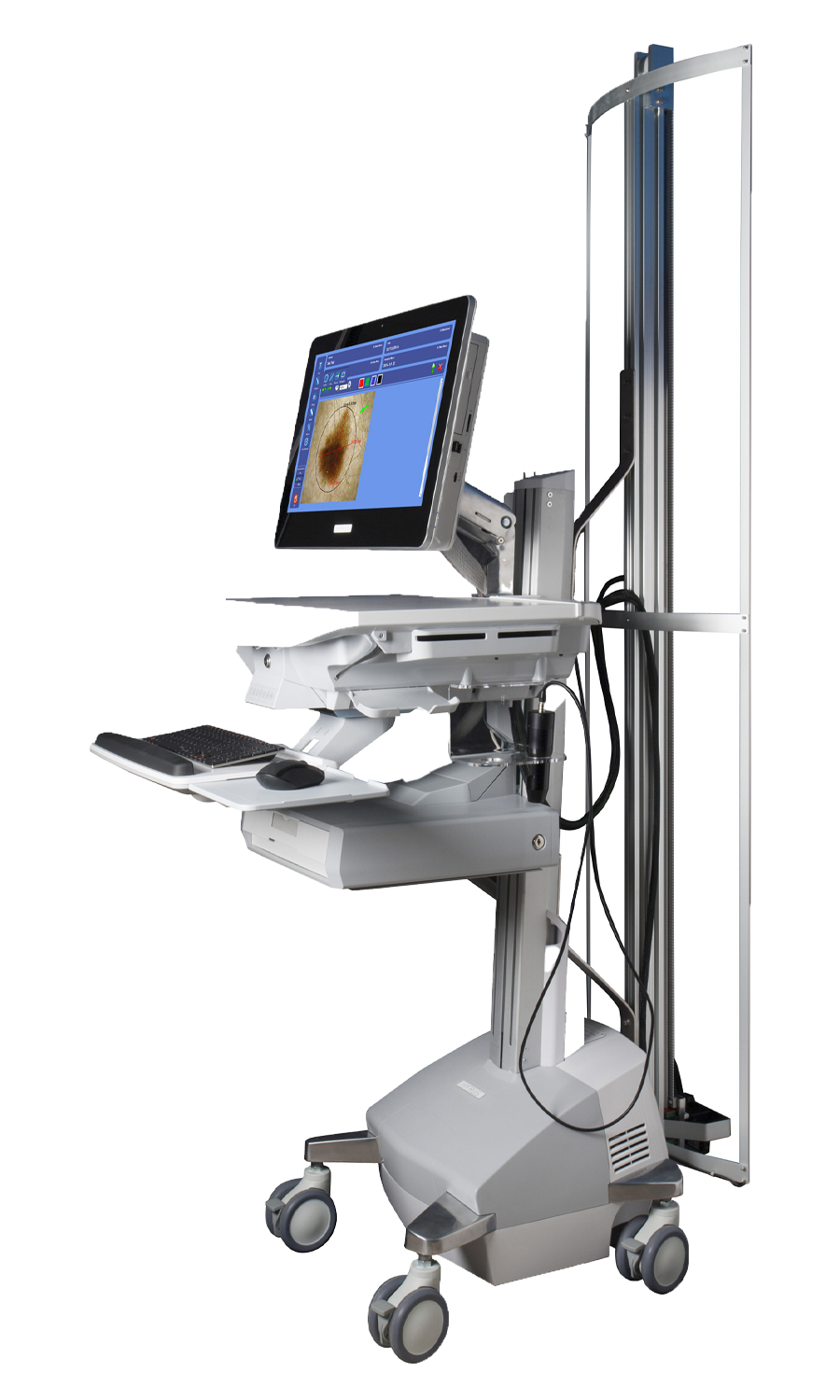 Videodermatoscope Total Body Horus HS1000 - Adamo SRL