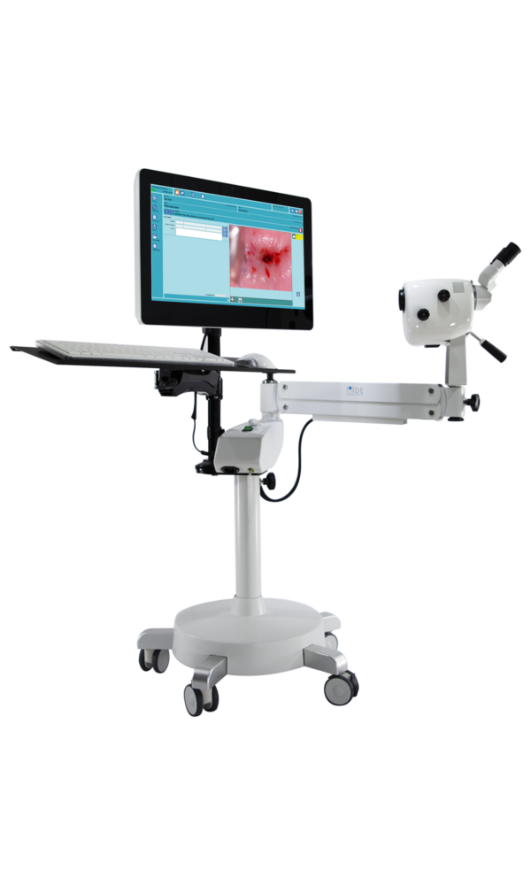 Adamo Videodermatoscopes, Videocapillaroscopes and Videocolposcopes