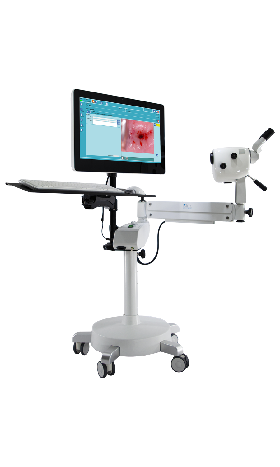 Adamo Videodermatoscopes, Videocapillaroscopes and Videocolposcopes