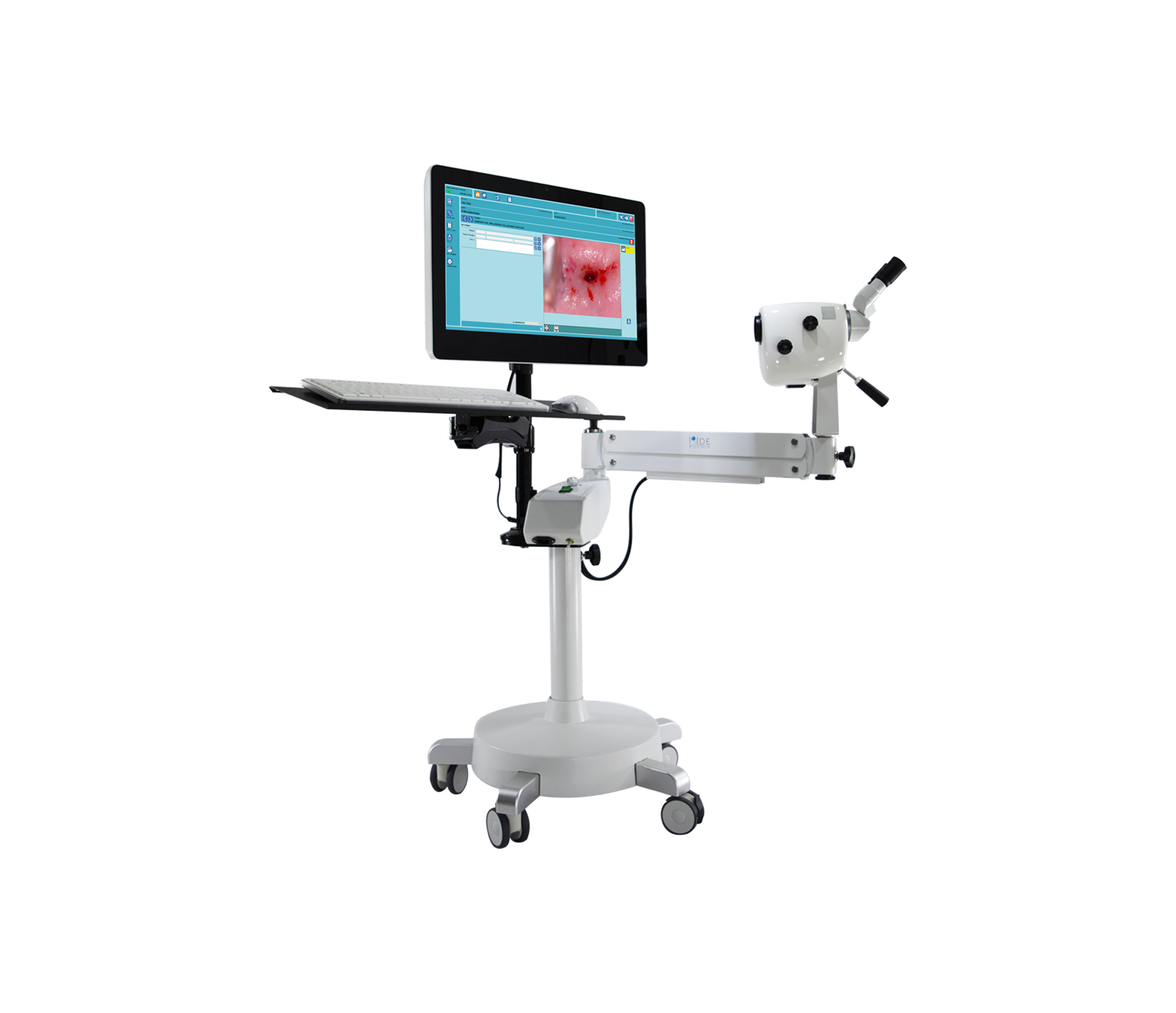 Videocolposcope Iside Beta - Adamo SRL